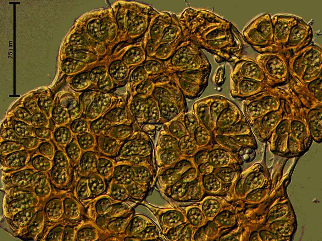 Interesting algae in the lake | Know Our Plants